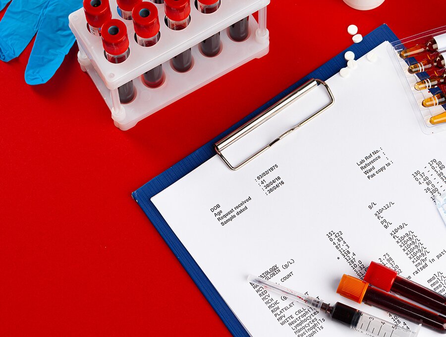 Laboratorijske pretrage: Što nam govore nalazi krvi